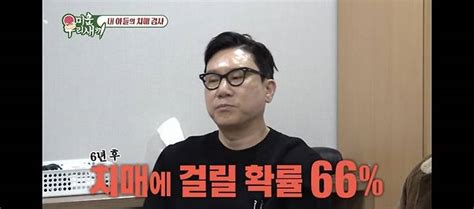 이상민 경도 인지장애 진단6년후 치매 확률 66↑