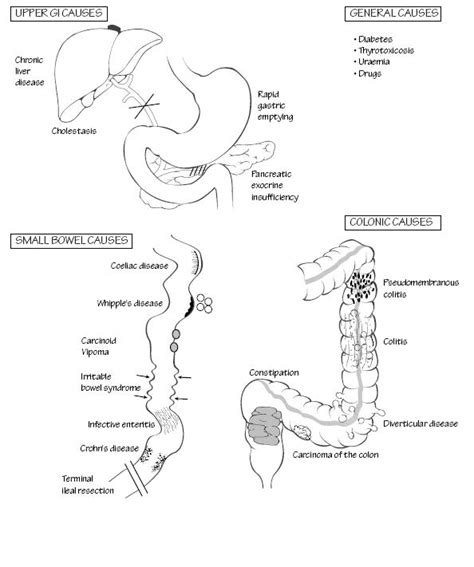 Surgery At A Glance Diarrhoea