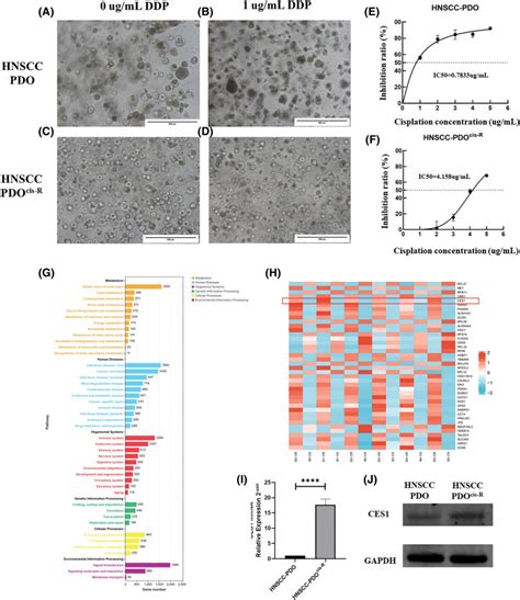 Ces1 Is Associated With Cisplatin Resistance And Poor Prognosis Of Head