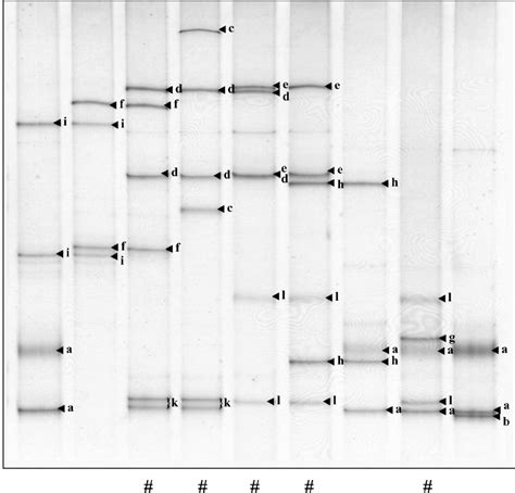 Single Strand Conformational Polymorphism Sscp Of The Caprine Dqa2 Download Scientific