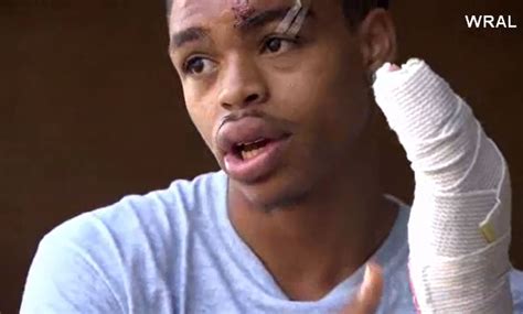 20 Year Old Beaten By White Supremacists Speaks Out After Photo Of Attack Goes Viral Wsyx