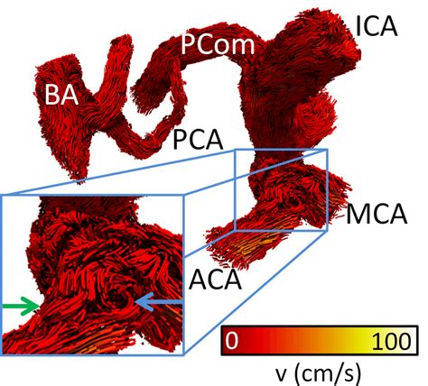 14 Streamline Visualization Of The Corrected Flow In A Section Of The Download Scientific