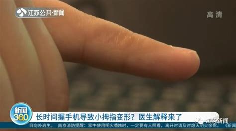 长时间使用电脑的职业人群，这些症状你有吗？关节骨头频道东方养生