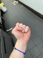 Hand Detection Object Detection Dataset By Catwithawand
