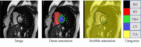 Figure 1 From Scribble Supervised Medical Image Segmentation Via Dual