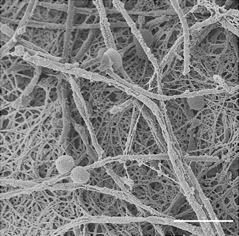 Scanning Electron Micrograph Of A Candida Albicans Biofilm Grown On A