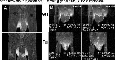 Pdf Mri Mrs On Leukemia Development In Mll Af 9 Transgenic Mice Semantic Scholar