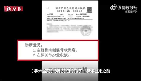 17歲少年左膝長骨瘤開刀！遭醫院「錯切右膝」 家屬怒轟太扯 兩岸大陸 三立新聞網 Setncom