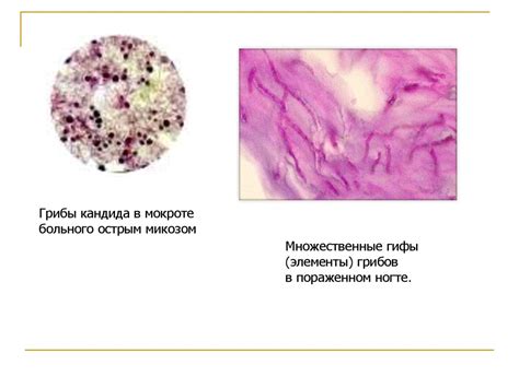 Патогенные грибы и вызываемые ими заболевания презентация онлайн