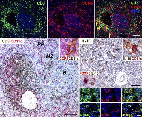 Ccr6⁺ T Cells Colocalize With Cd11c⁺ Dcs And Produce Il 10 In The Human Download Scientific