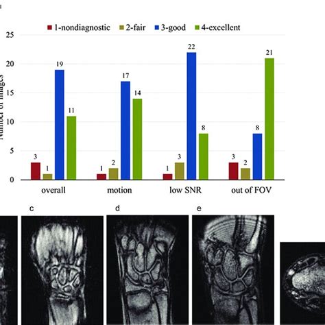 Results Of Image Quality Evaluation And Image Examples A Image