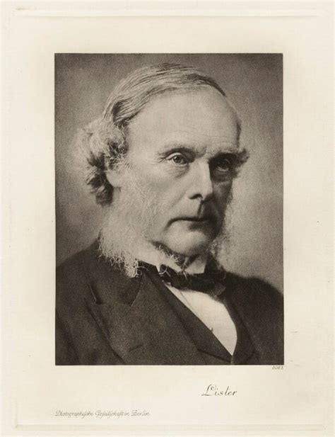 Lister