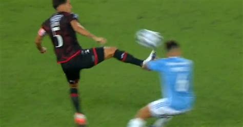 Sporting Cristal Vs Huracán Jesús Pretell Recibió Brutal Patada Pero