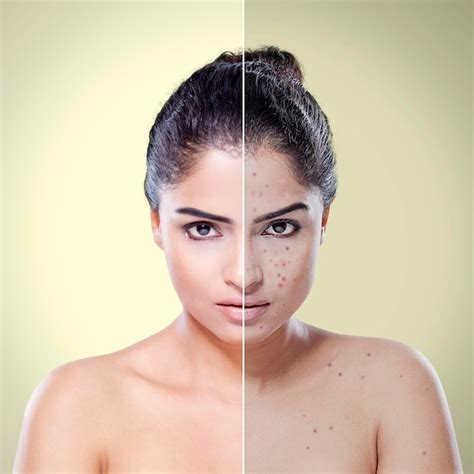 Premium Photo Young Woman Before And After Skin Care