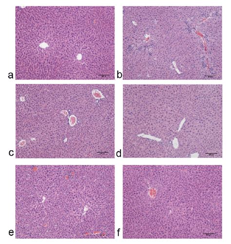 histological evaluation of liver a vehicle control b db 250