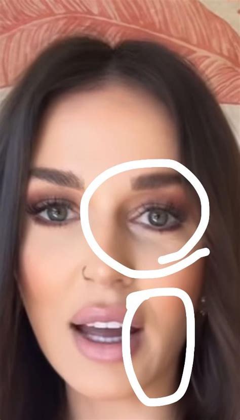 Whats Wrong With Her Face And These Weird Lines Wrinkles Shes In Her 20s🤯🤯🤯 R