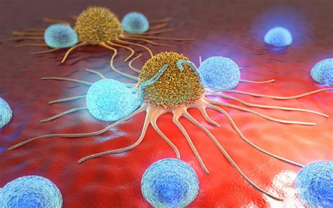 Can Early Intervention Alter The Course Of Metastatic Cancer
