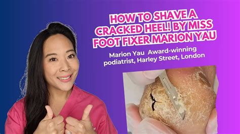 How To Shave A Cracked Heel Asmr By Miss Foot Fixer Marion Yau Youtube