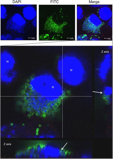 Localization Of Inclusion Bodies Formed In The Hep 2 Cells Infected