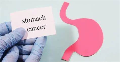 Hipec Surgery Treatment Cost In India Best Doctors For Hipec Surgery Treatment Planmymedical