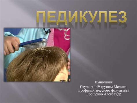 Педикулез: симптомы, клиника, диагностика, лечение - презентация онлайн