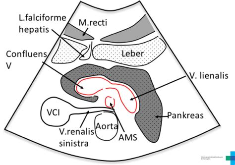 Normalbefunde Bauchgefäße Sonographieatlas Erlangen