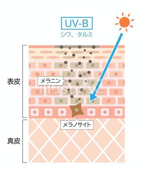 B Uvb No Ac
