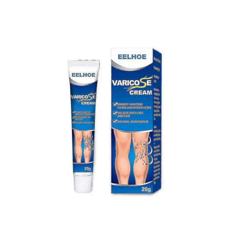 Varicose Vein Cream Spider Varicose Vein Treatment Cream Improves Blood