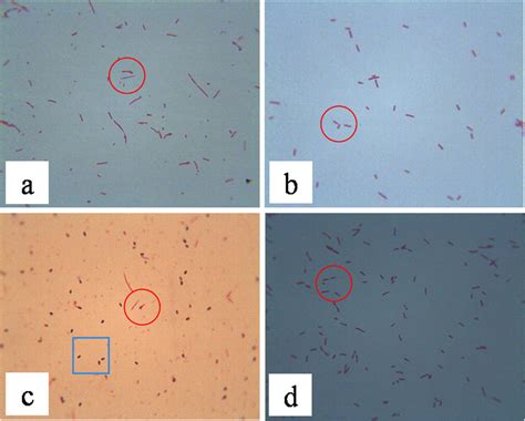 Scanning Electron Micrographs Of The Microorganisms In Different Download Scientific Diagram