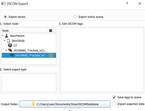 save stl segmentation to image format support 3d slicer community