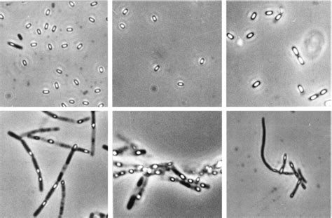 Sporulation Phase Contrast Microscopy Of Cultures Grown In Difco Download Scientific Diagram