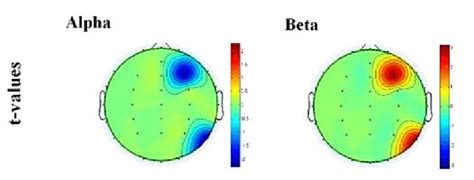 Topographic Map Of Statistical Differences Between Relative EEG Power Download Scientific