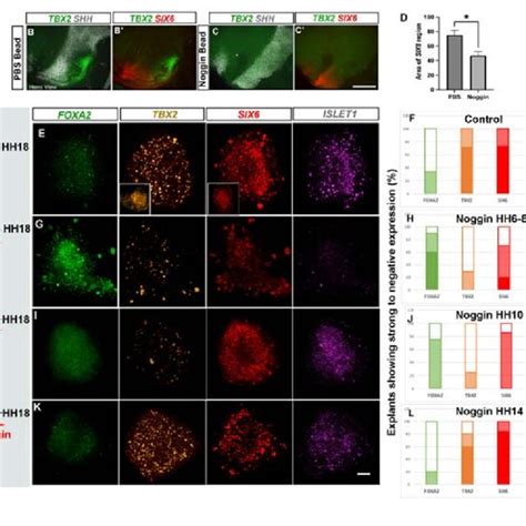 bmp signalling patterns anterior and posterior tuberal progenitors