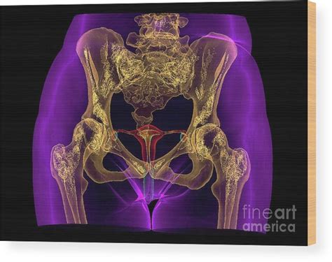 Female Reproductive Organs And Pelvic Bones Wood Print By Science Photo