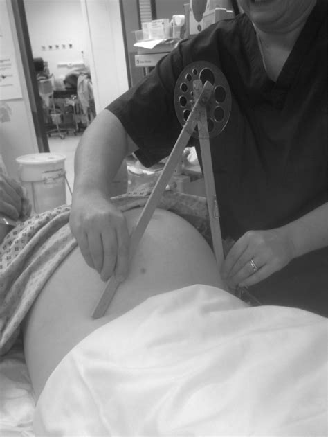 Does Body Mass Index Influence The Degree Of Pelvic Tilt Produced By A