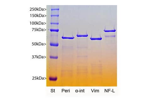 Recombinant Human Peripherin Protein A270574