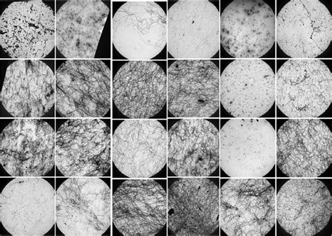 Cytoskeleton Electron Micrograph