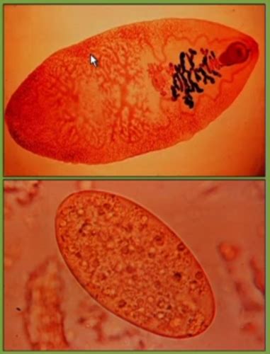 Chapter 55 Intestinal Trematodes Flashcards Quizlet
