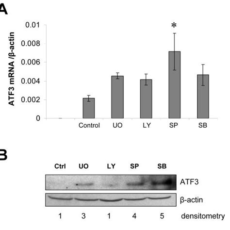 Expression Of Atf3 In Human Colon Cancer Corresponding Colon Cancer