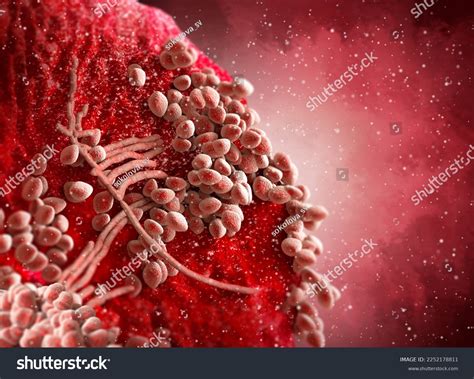 Medical Background Staphylococcus Aureus Type Spherical Stock