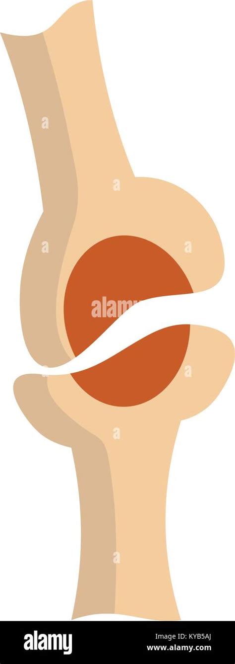 Knee Replacement Xray Stock Vector Images Alamy