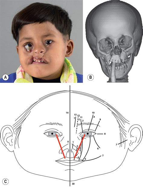 Craniofacial Abnormalities Clinical Tree