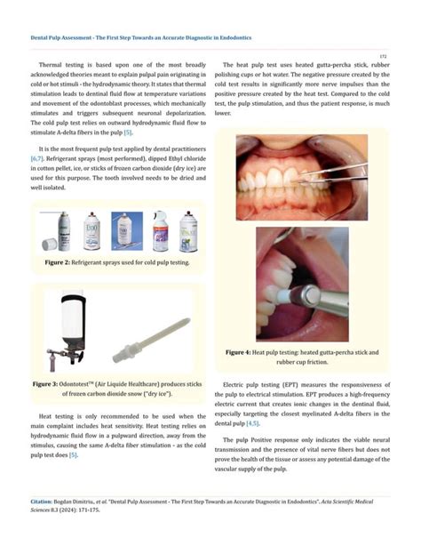 Dental Pulp Assessment The First Step Towards An Accurate Diagnostic