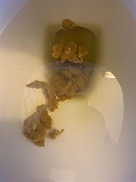 Cant Stop Having These Poops Rpoop