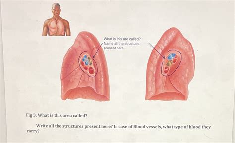 What Is This Are Called Name All The Structues Present Here Fig
