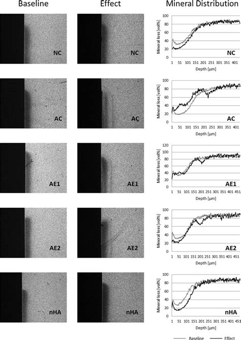 Representative TMR Images Of The Lesions Before Left And After Download Scientific Diagram
