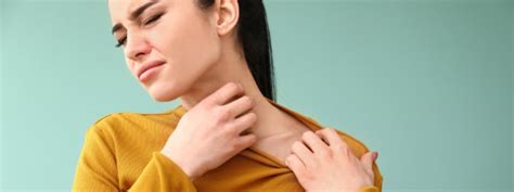 Chronic Spontaneous Urticaria Chronic Hives Skin Care Research