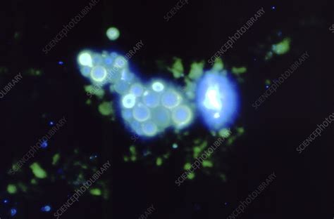 Cryptococcus Neoformans Fungus From Nasal Sample Light Micrograph Stock Image C059 7322