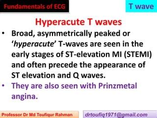 Approach To A Patient With T Wave Abnormality In ECG PPSX Heart And Cardiovascular Diseases