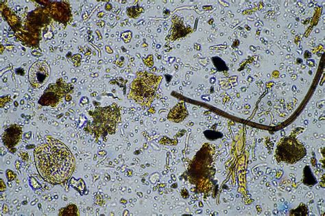 Fungi Under Microscope Images Free Download On Freepik